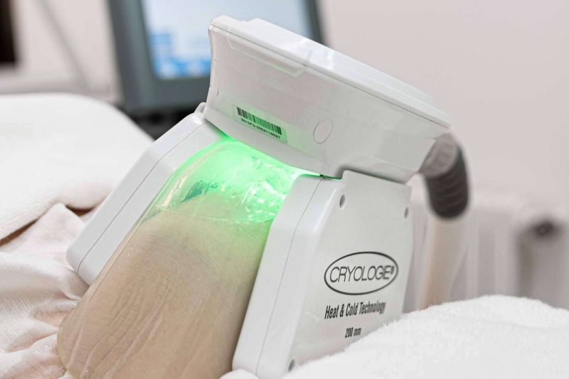 ¿Cómo reducir la grasa localizada? Tratamientos combinados de ...