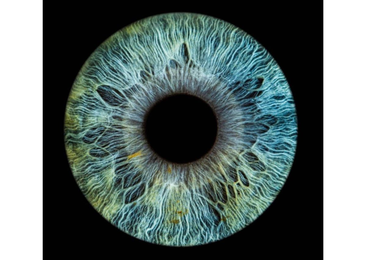 La clínica Eyecos y su software con tecnología puntera para evaluar el ...